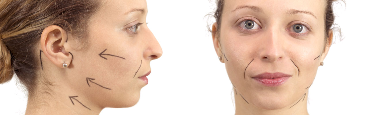 Lifting del Viso e del Collo - Prof. Alessandro Massei | Chirurgo ...